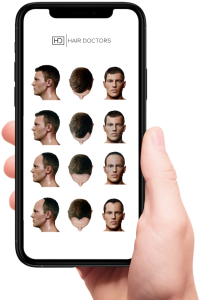What is a Hair and Scalp Analysis? - Hair Doctors