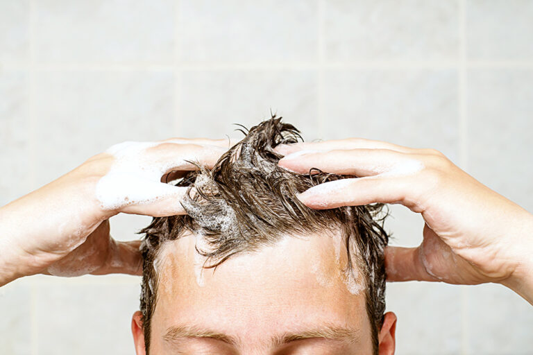 Does Washing Hair Everyday Lead To Hair Loss? Hair Doctors