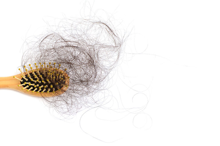 Why Does my Hair Keep Falling Out? | Hair Doctors Sydney